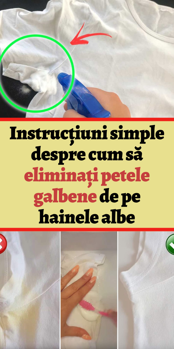 Instrucțiuni simple despre cum să eliminați petele galbene de pe ...